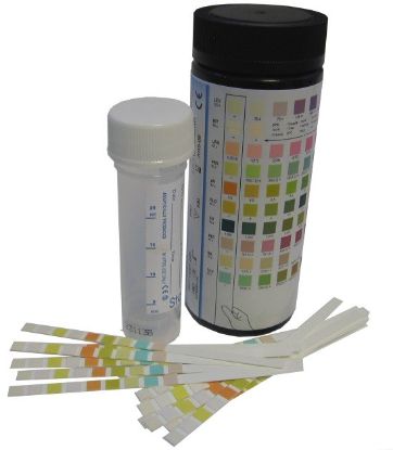 Urinalysis (Insight) 10 Parameter Test Strips | My Website